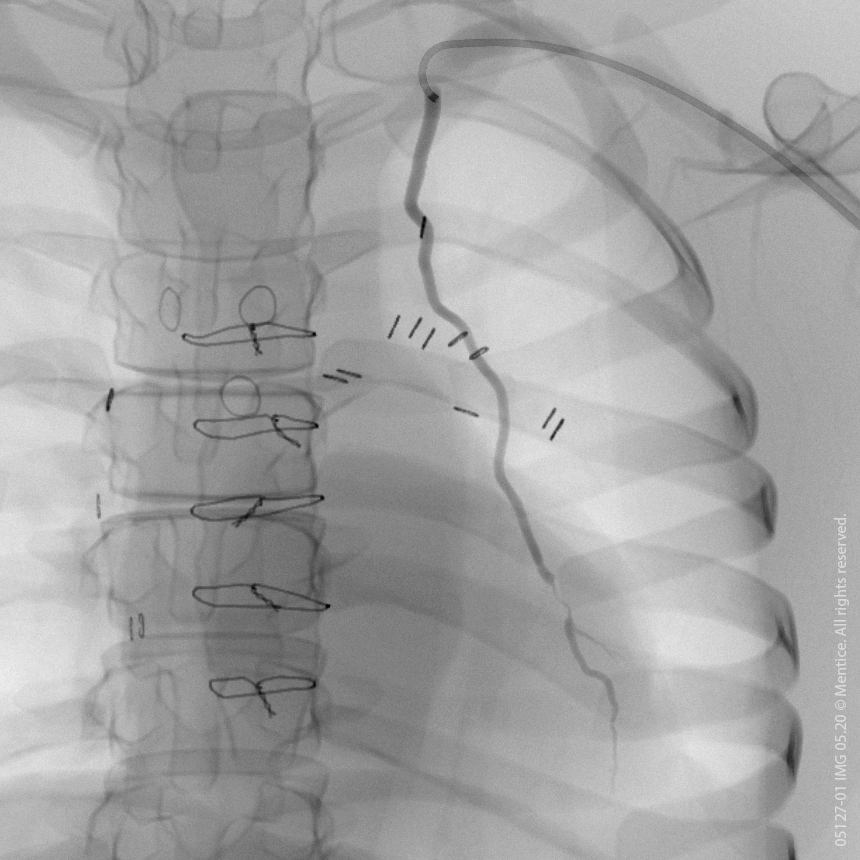 Coronary Intermediate | Software